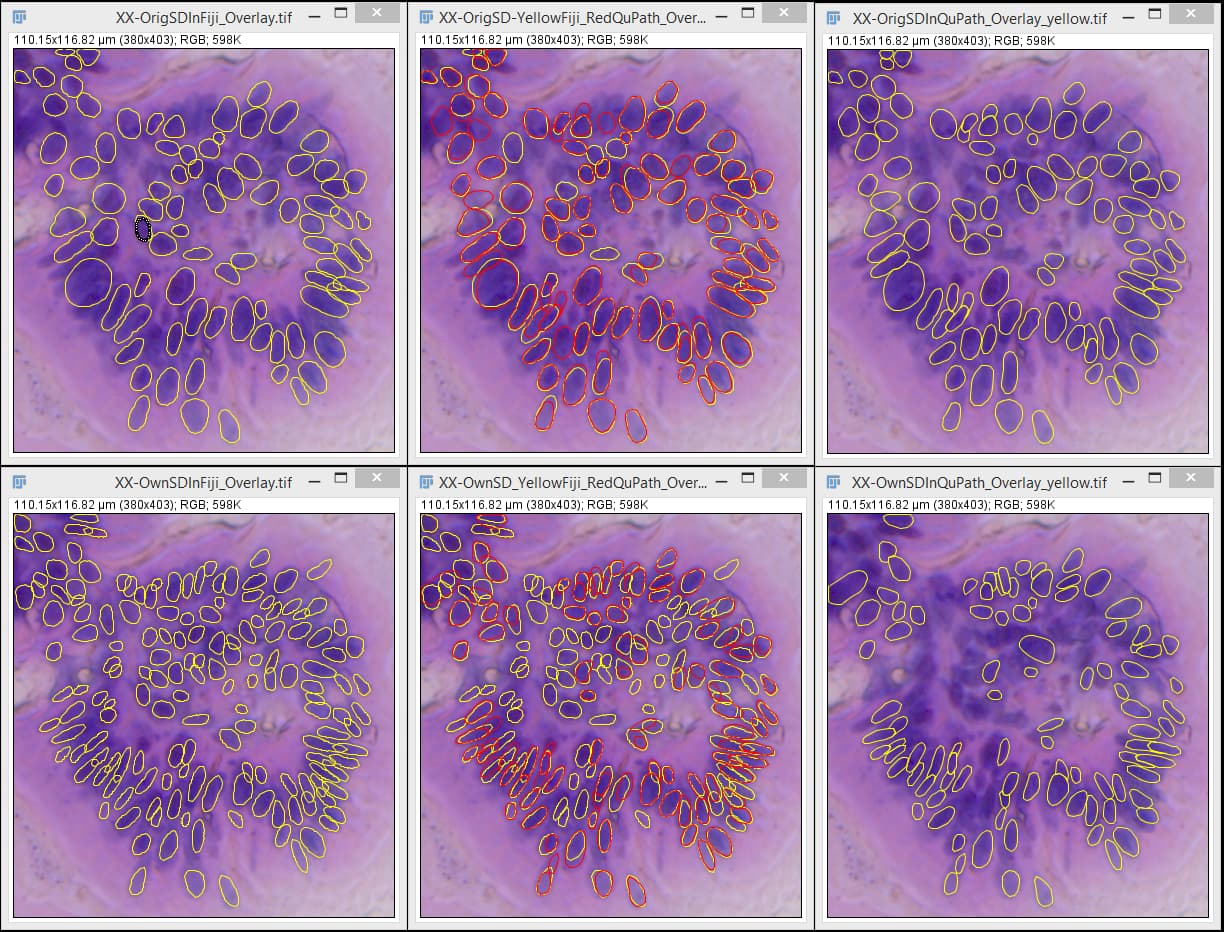 StarDist in QuPath Normalization issue - Usage & Issues - Image.sc Forum