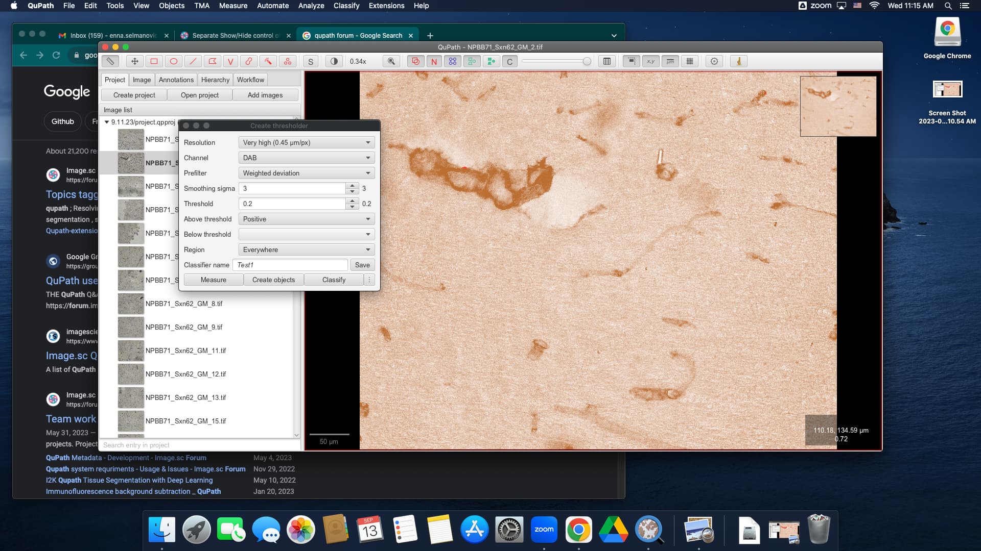 Pixel Classifier/Thresholder Not Picking Up Intensities? - Image Analysis - Image.sc Forum