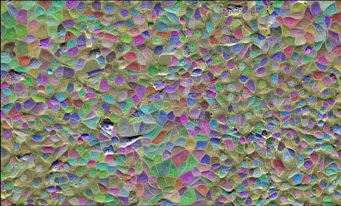 Segmenting cell image from CD7 microscope - Image Analysis - Image.sc Forum