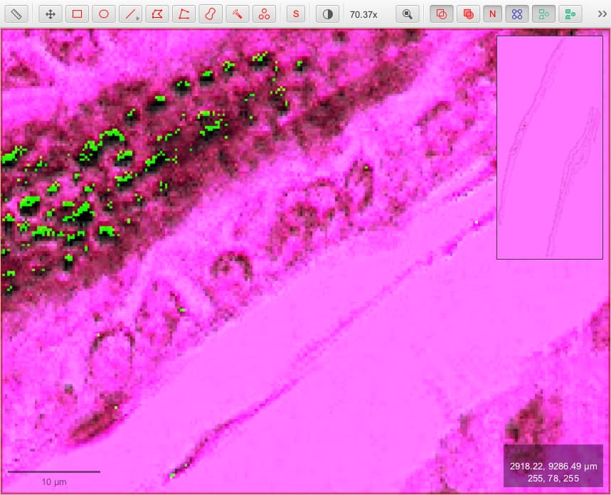 Qupath Can T Open Svs Images From Aperio Versa Slide Scanner Image Analysis Image Sc Forum