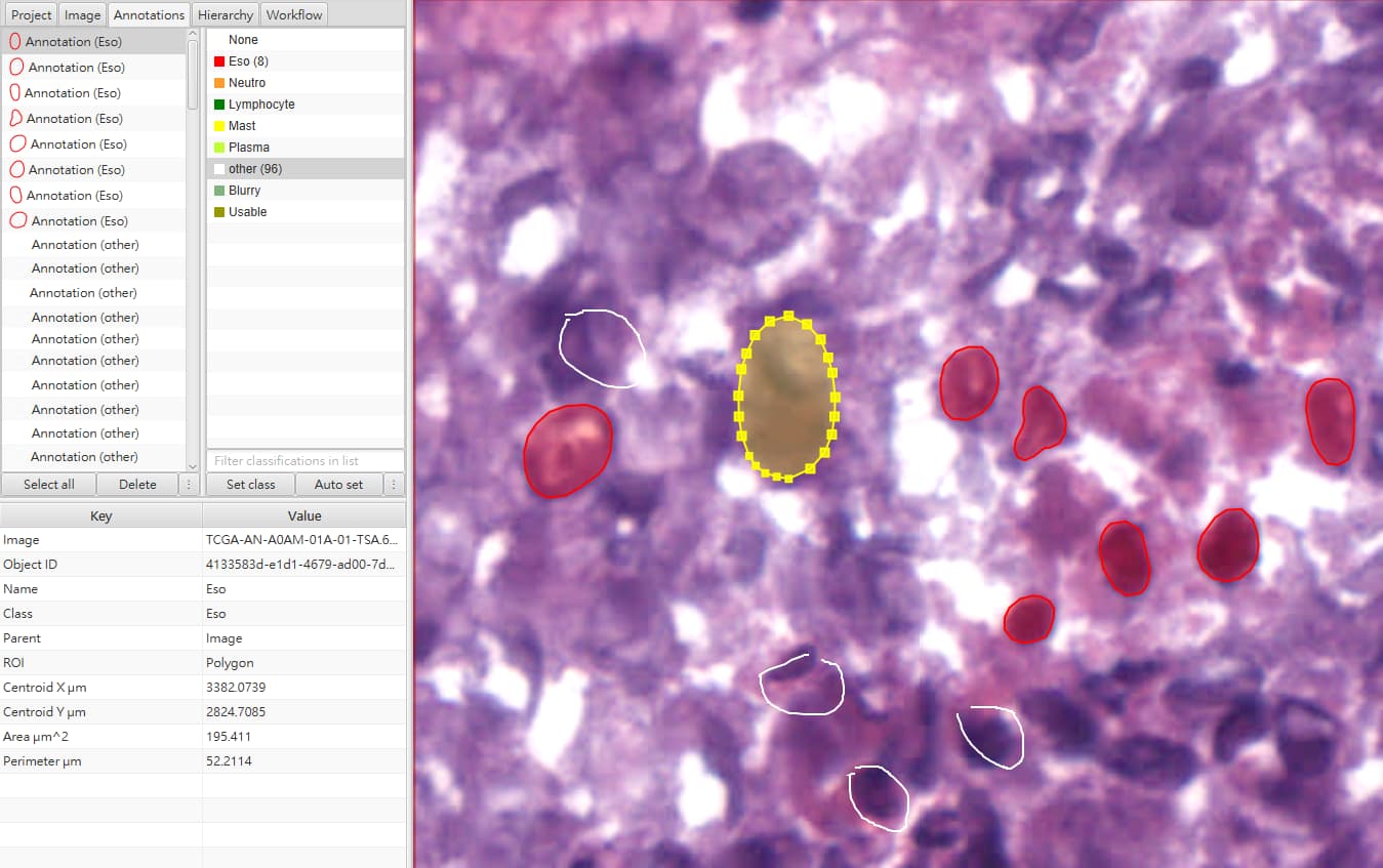 How to select annotations according to their ROI types? - Usage & Issues - Image.sc Forum