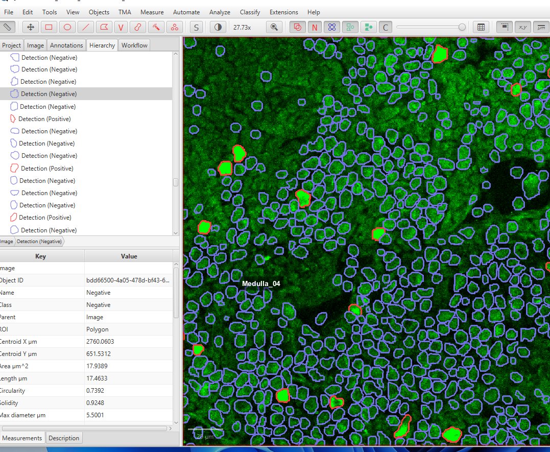 Qupath Positive/negative cells : how to filter negative cells - Image Analysis - Image.sc Forum
