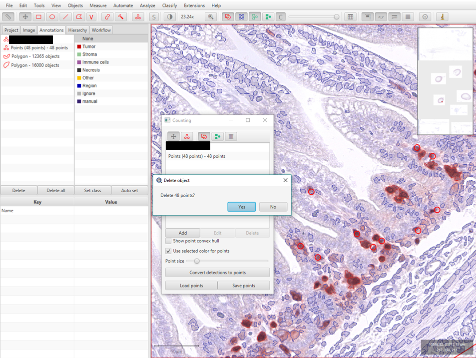Remove Annotations During Manual Counting Image Analysis Image Sc Forum