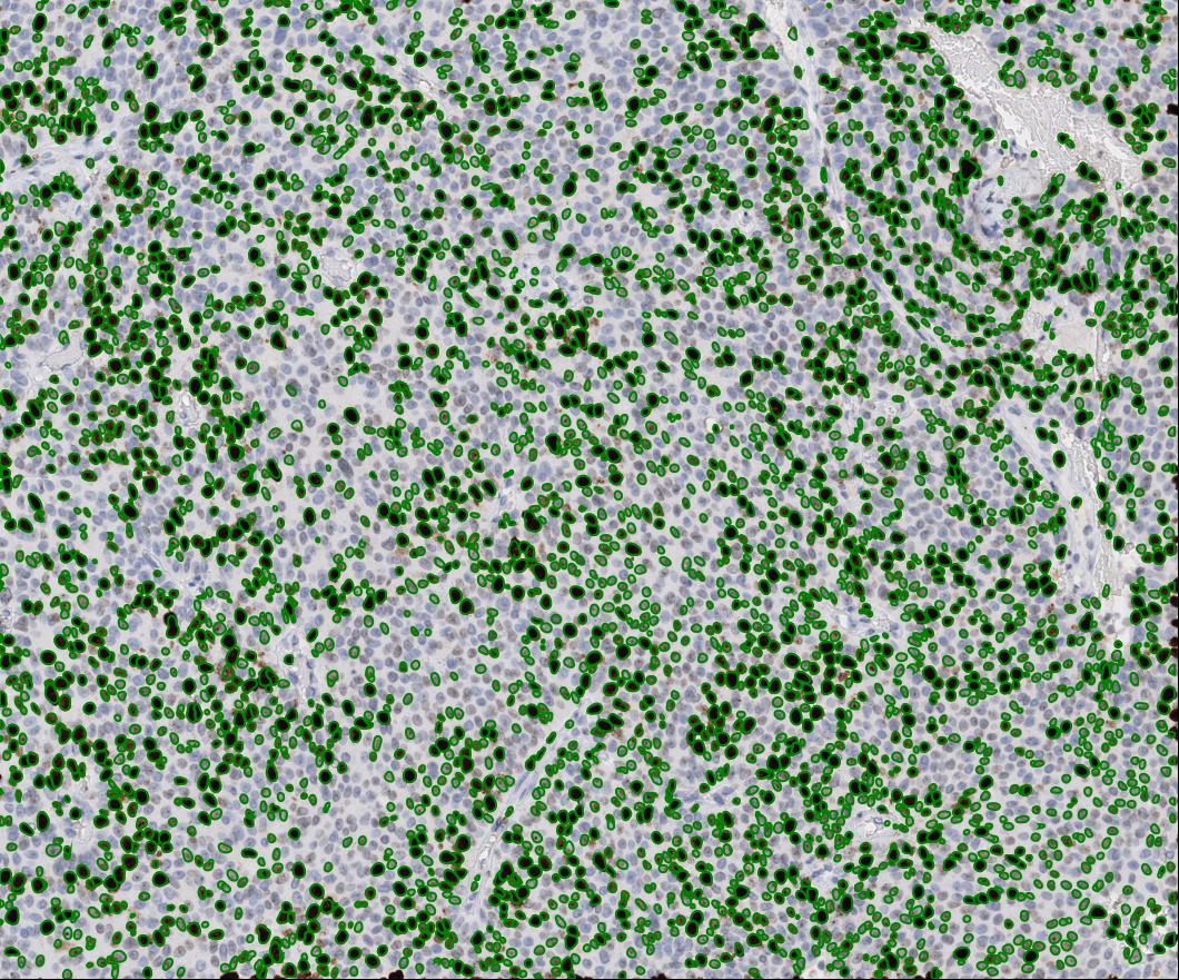 QuPath batch script for DAPI nuclear detection - Image Analysis - Image.sc Forum