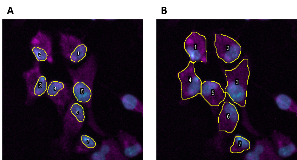 Can ROIs be linked to other ROIs in Fiji? - Image Analysis - Image.sc Forum
