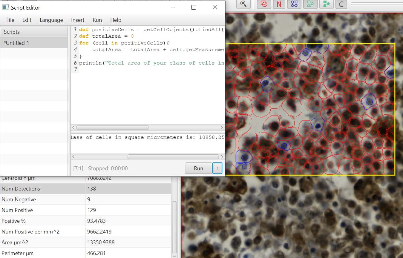 Why does positive cell detection and cell detection with the object classifier show different ...