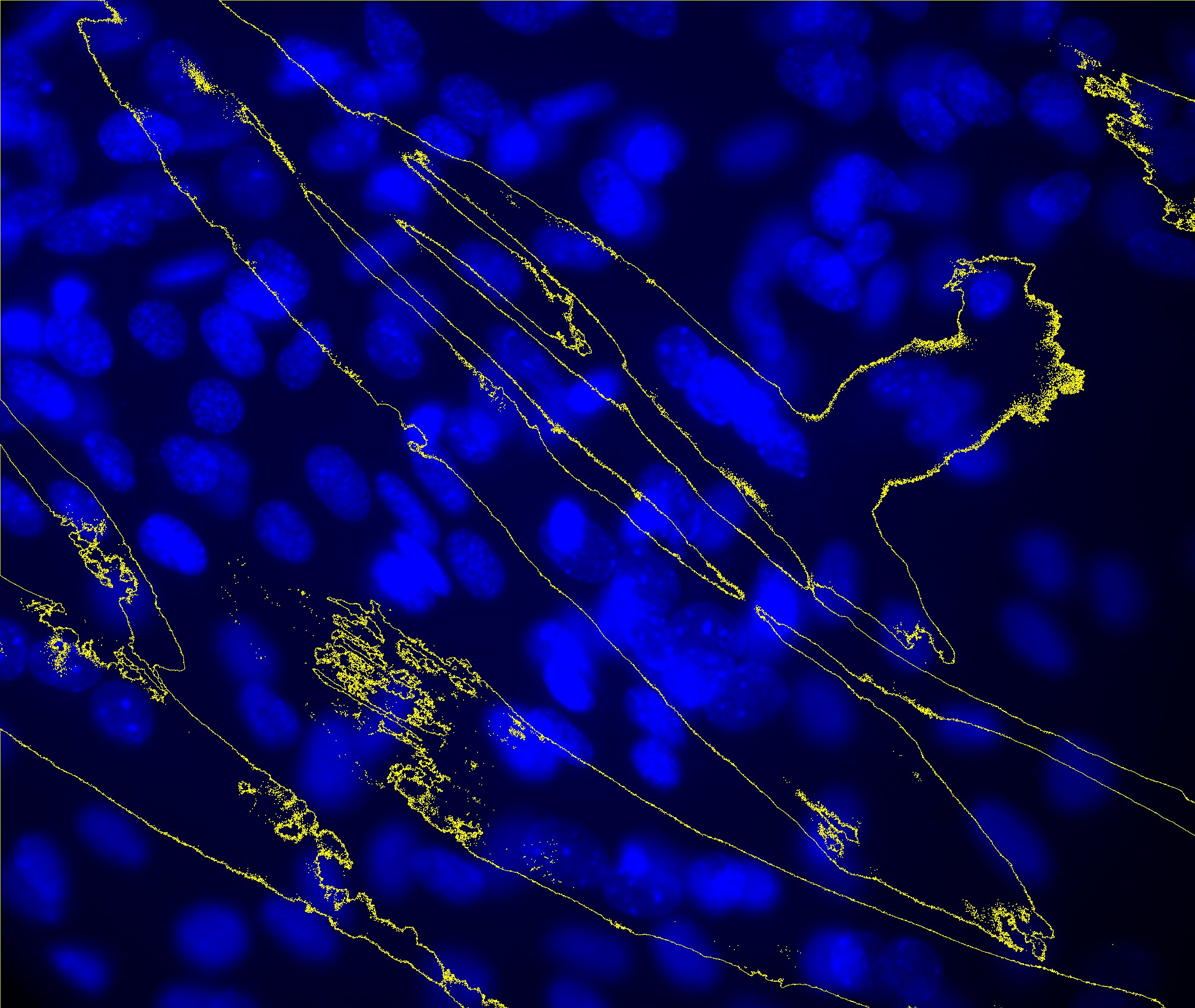 Creating a overlay/mask/roi from a binary image and overlaying it onto ...
