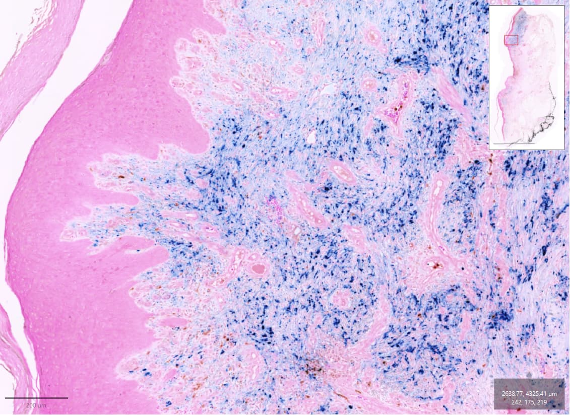 ᴗ•)/ QuPath scripting (#6): Customized 3 stain color deconvolution - Usage & Issues - Image.sc Forum