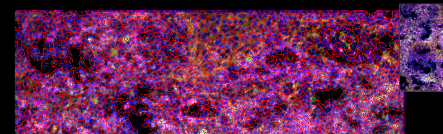 Transferring Segmentation Predictions From Custom Masks To Qupath Usage And Issues Imagesc Forum