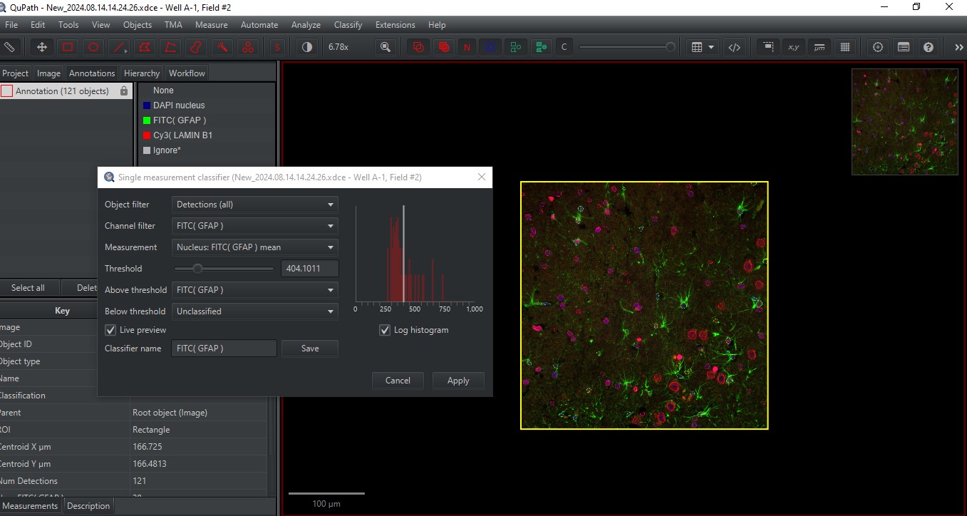 GFAP+ cell and Lamin B1 on fluorescence image in Qupath - Image Analysis - Image.sc Forum