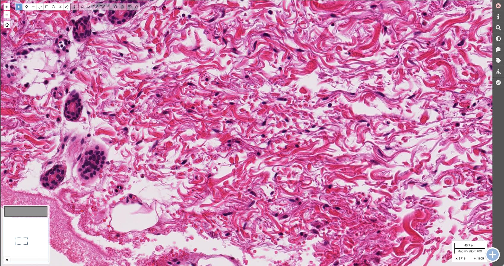 Visualization problems with NDPI data in Cytomine - Usage & Issues - Image.sc Forum