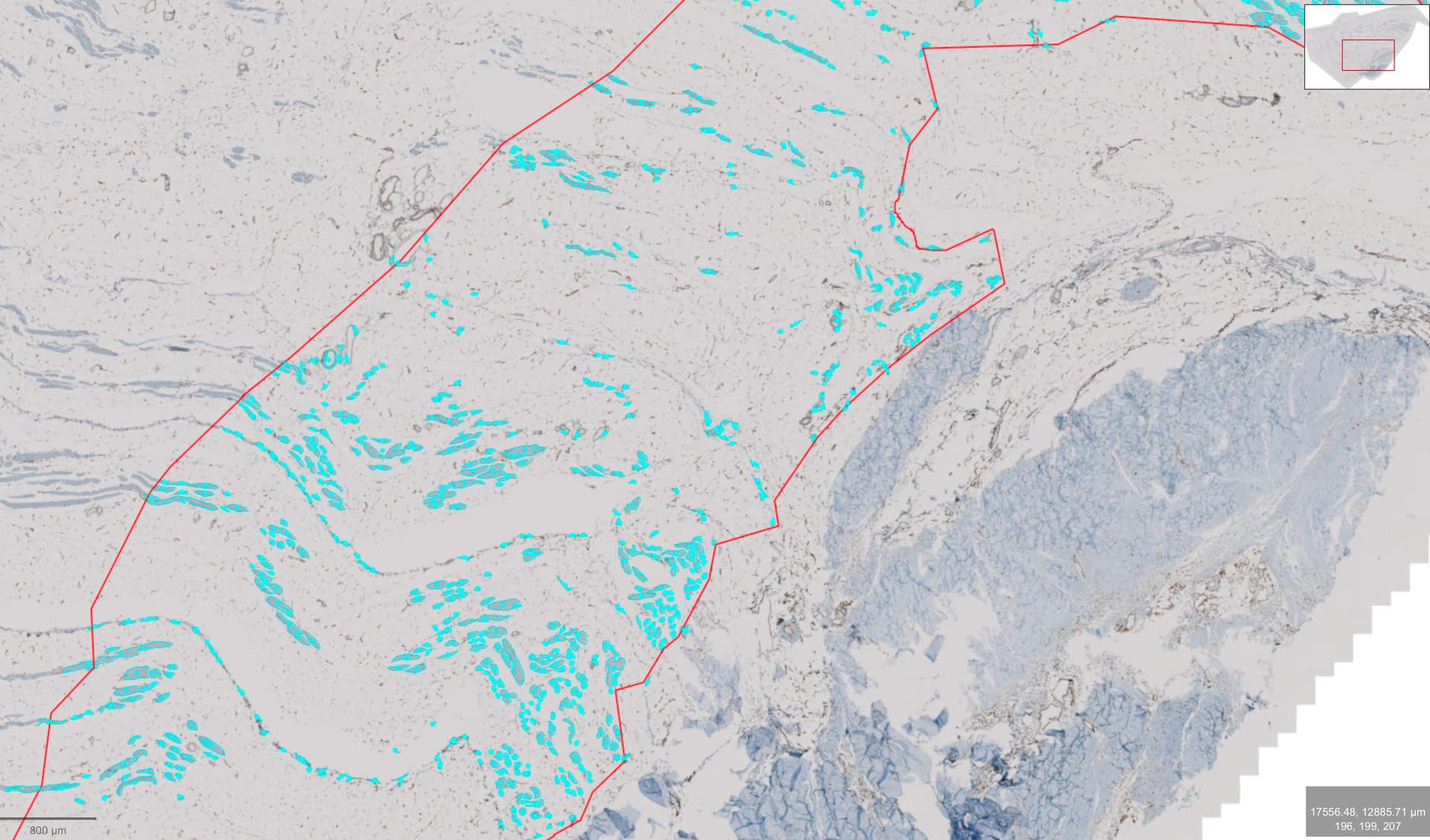 Qupath Script Command To Draw Polygon Annotation From Points Image Analysis Imagesc Forum
