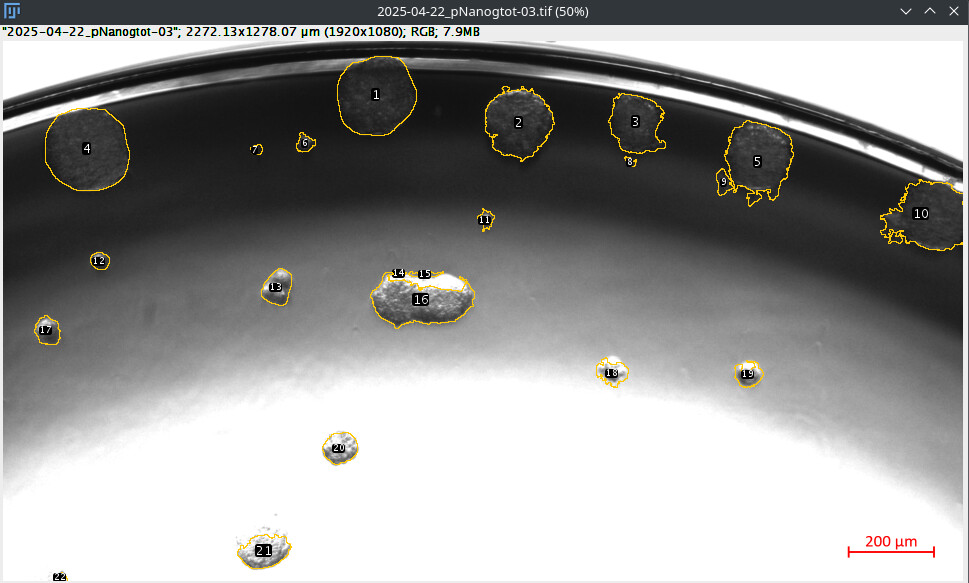 ImageJ macro help - Image Analysis - Image.sc Forum