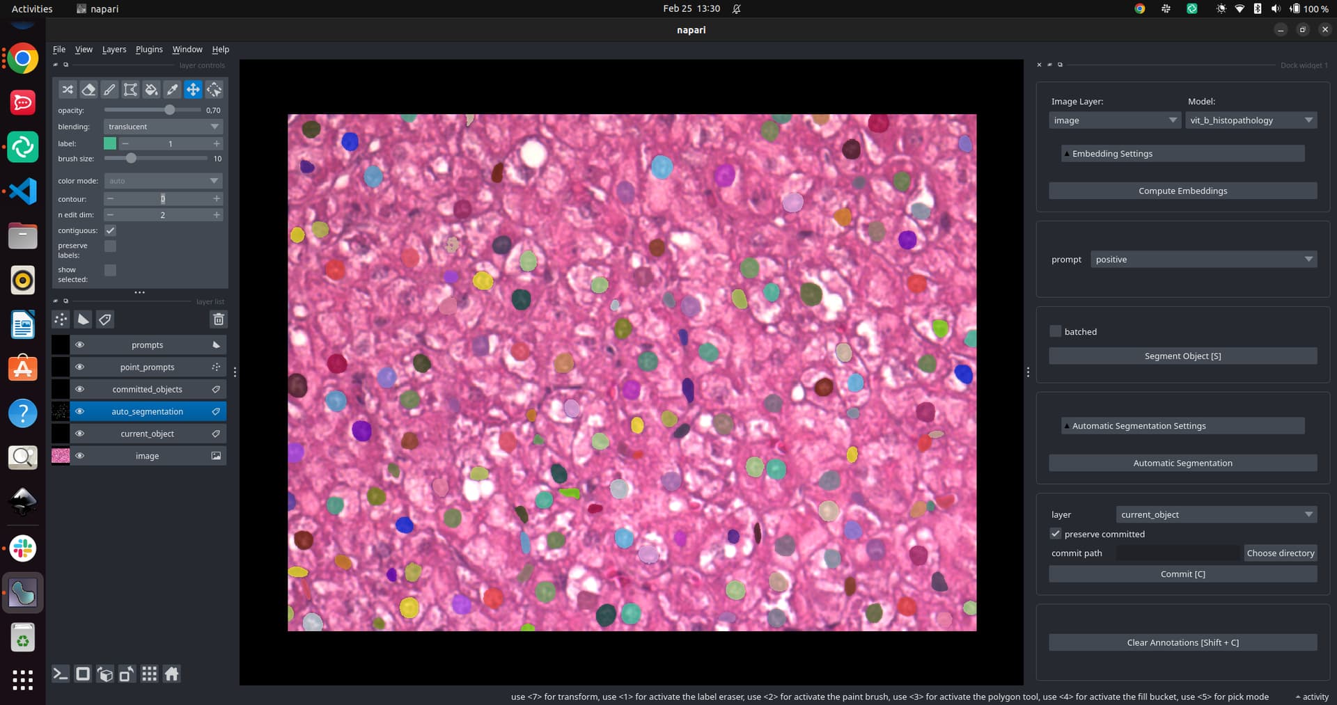 Enhancing and Identifying Nuclei (H&E stain) - Image Analysis - Image.sc Forum