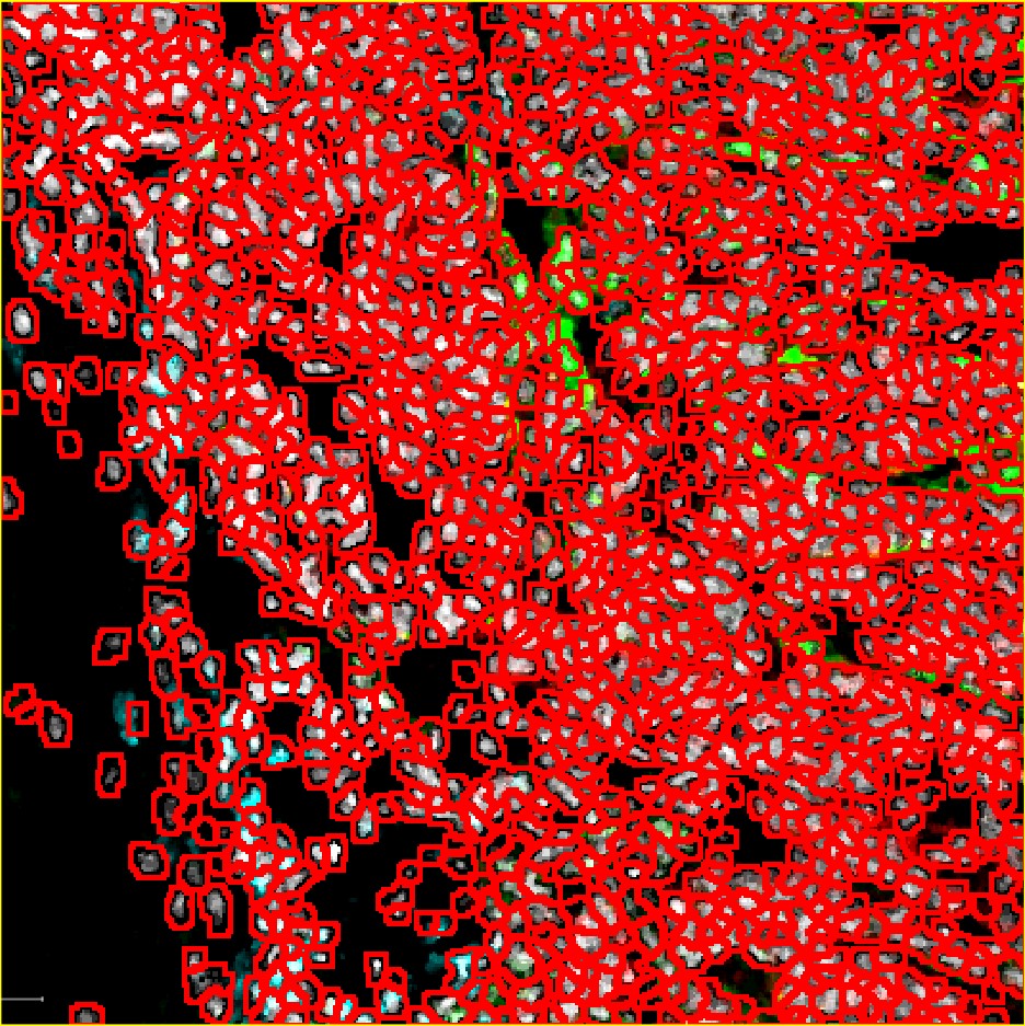 Sequential Segmentation In Qupath Image Analysis Image Sc Forum