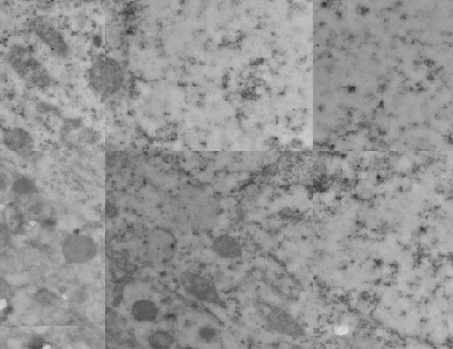 Histogram Equalization and Normalization + Intensity matching in TrakEm2 - Image Analysis ...