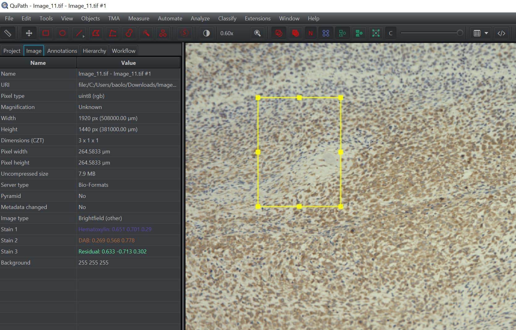 I couldn't use cell detection in QuPath 0.6.0 - Usage & Issues - Image.sc Forum
