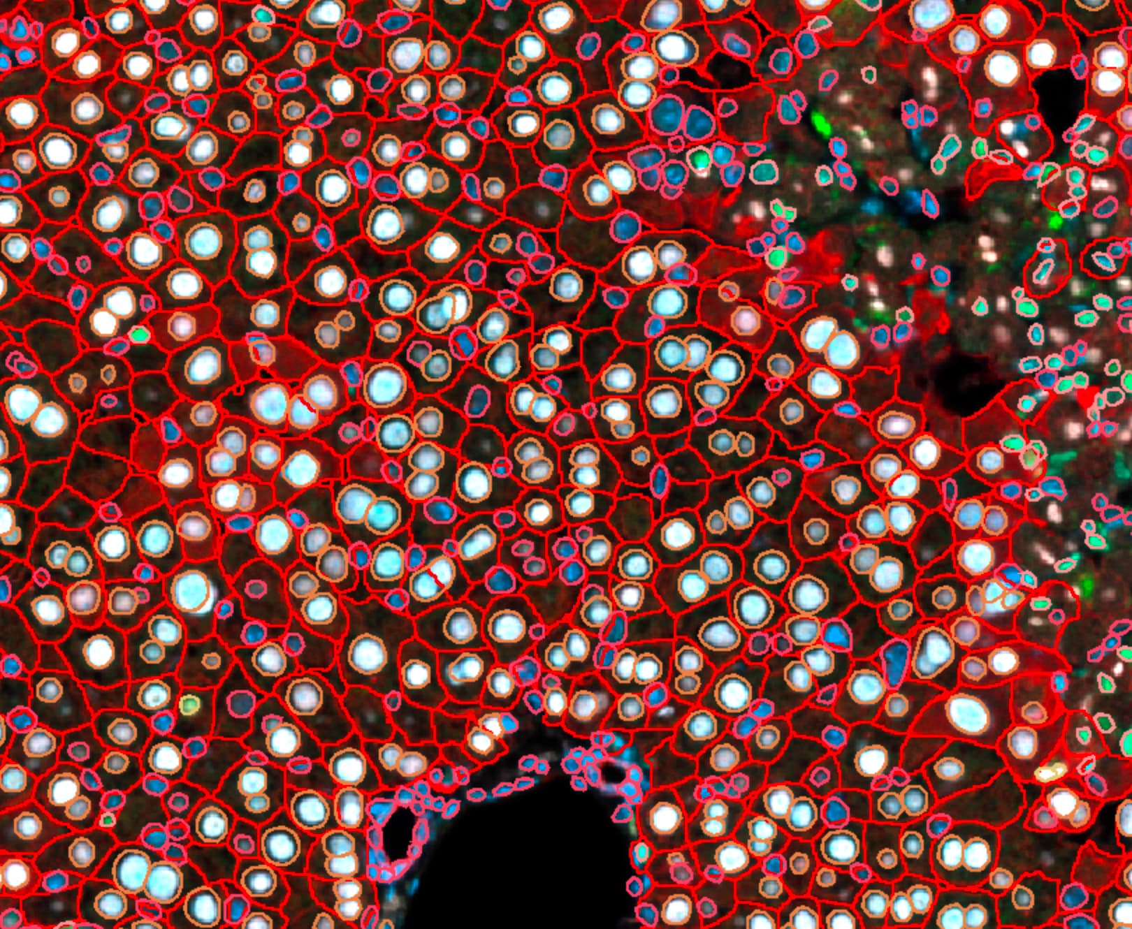 Combining CellPose and StarDist objects - Image Analysis - Image.sc Forum