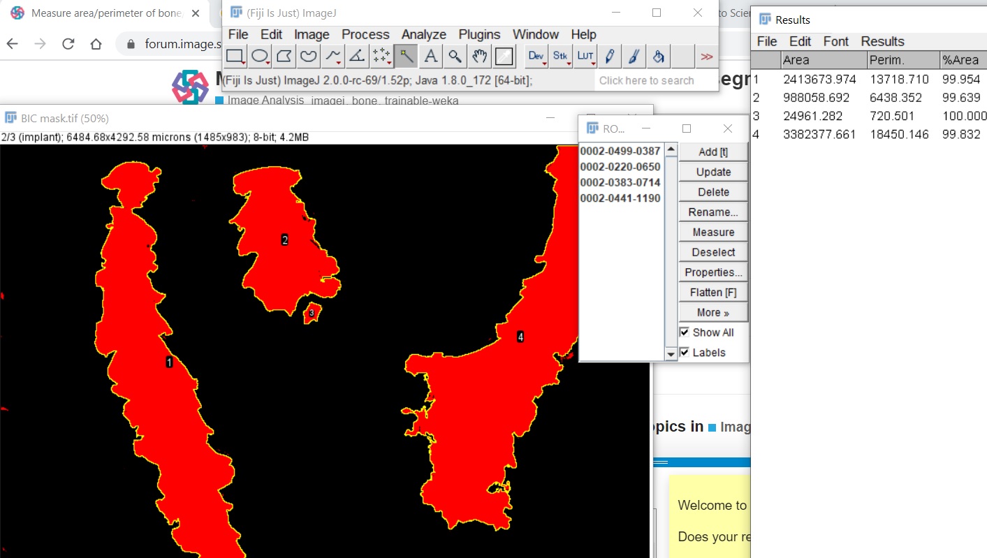 Measure area/perimeter of bone/implant using weka segmentation - Image Analysis - Image.sc Forum