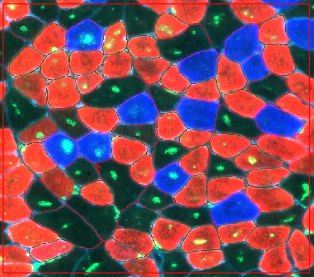 Subcellular detection after Cellpose segmentation - Image Analysis - Image.sc Forum