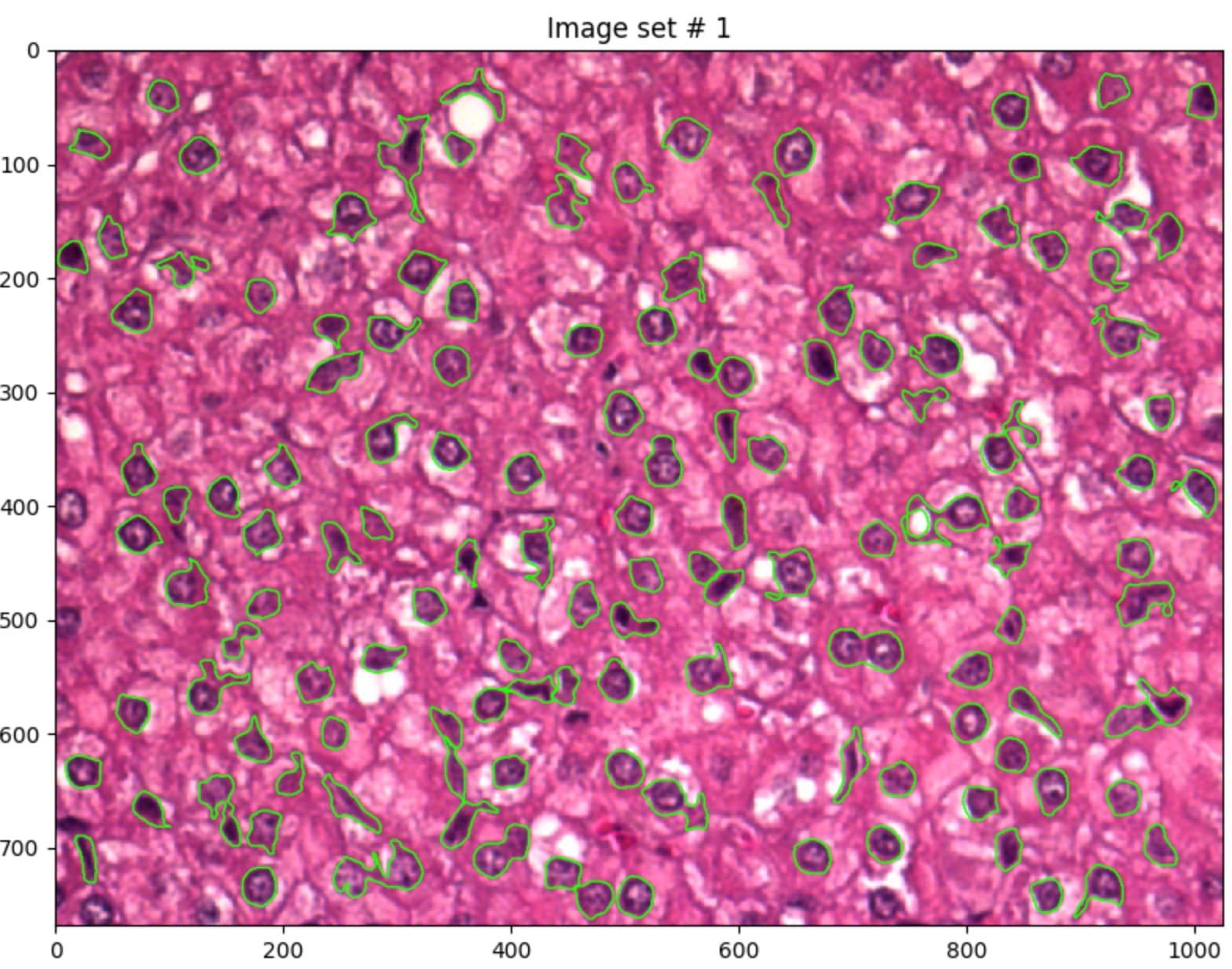 Enhancing and Identifying Nuclei (H&E stain) - Image Analysis - Image.sc Forum