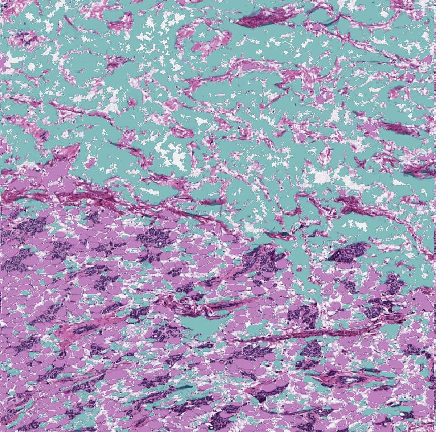 Can Creating Detections From Pixel Classifier Be Made To Run Faster Image Analysis Image Sc