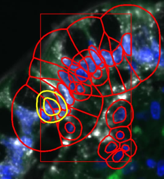 Stardist Cell Expansion With Conditions Image Analysis Image Sc Forum