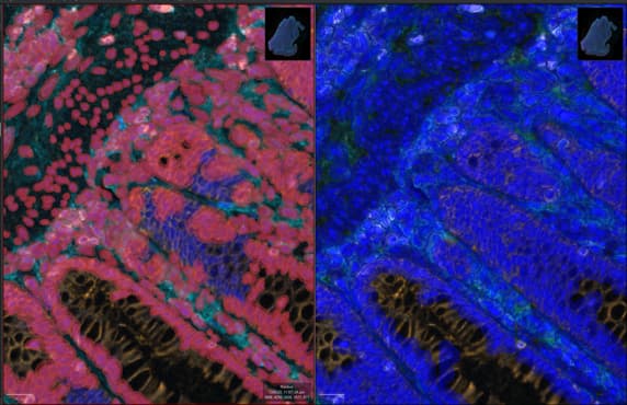 Stardist Extension For Qupath Struggling With Extremely Dense Clusters Of Cells In Mif Usage