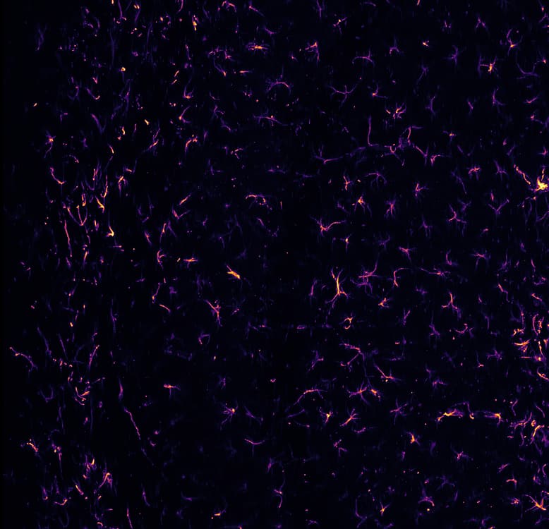 Problematic 2D/3D fibrous cell segmentation - Image Analysis - Image.sc ...