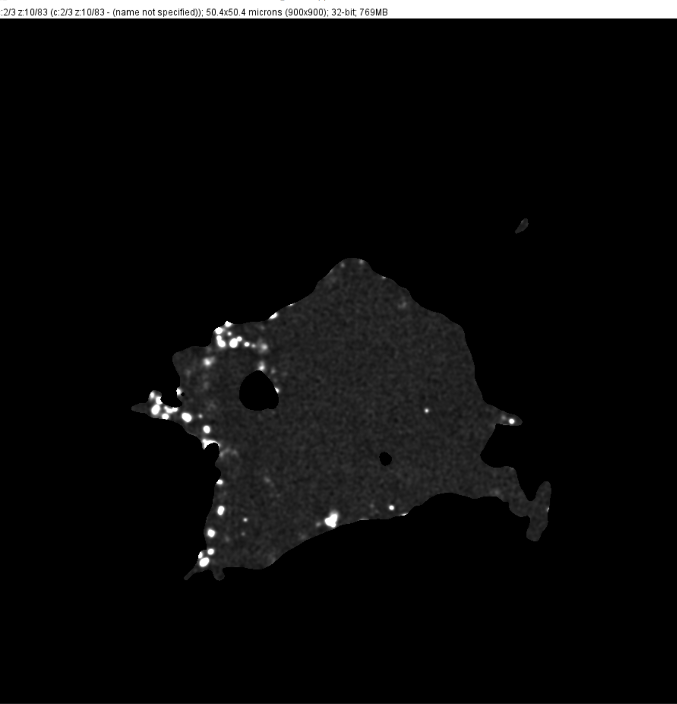 Z-stack thresholding and colocalization with ImageJ - Image Analysis ...