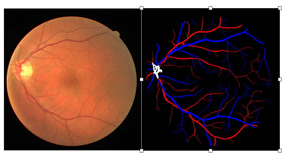 Efficient way for dataset creation of vasculature segmentation of ...