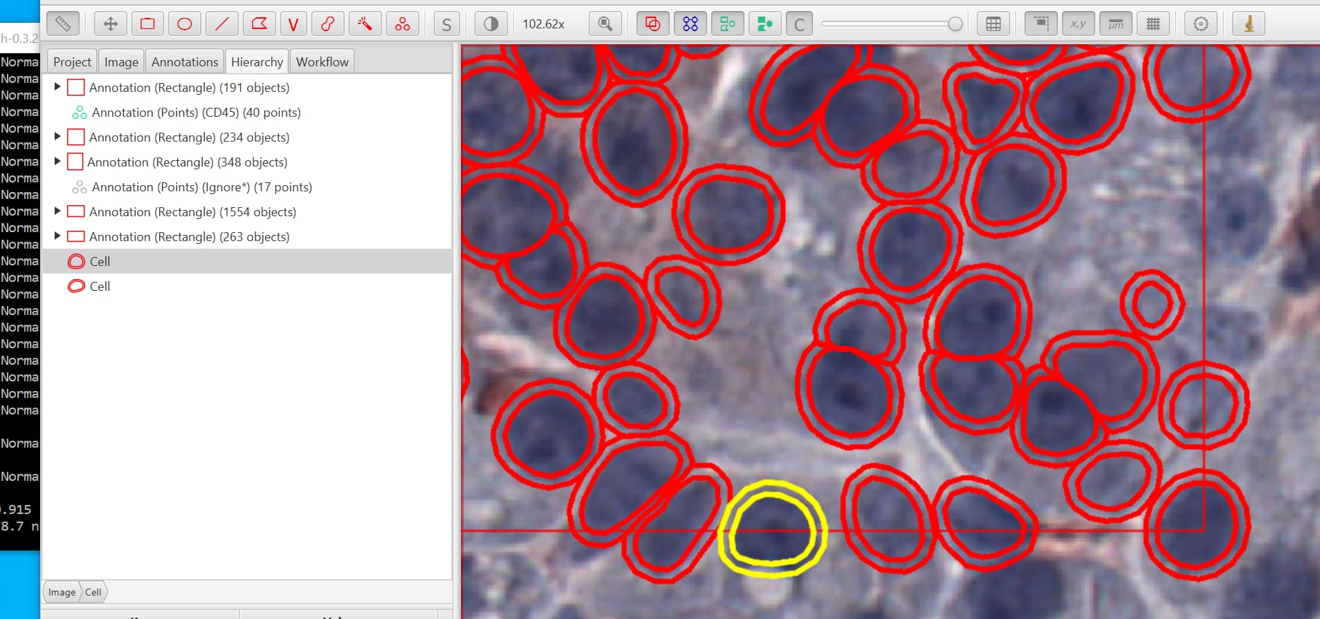 Stardist Hierarchy Bug - Usage & Issues - Image.sc Forum