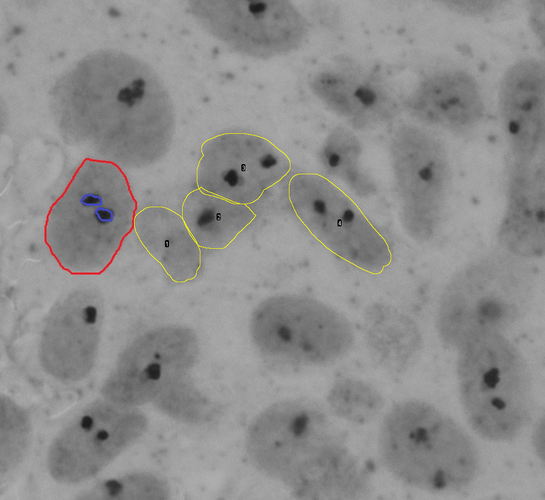 Nucleus/Cytoplasm - Nucleolus/Cytoplasm ratios image analysis - Image Analysis - Image.sc Forum