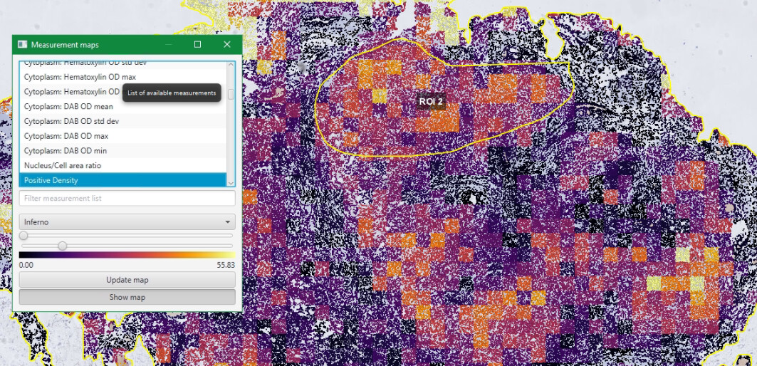 Cell Density Map - Image Analysis - Image.sc Forum
