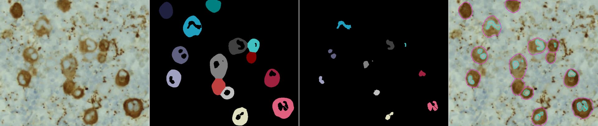 Cell detection with unstained nucleus - Usage & Issues - Image.sc Forum