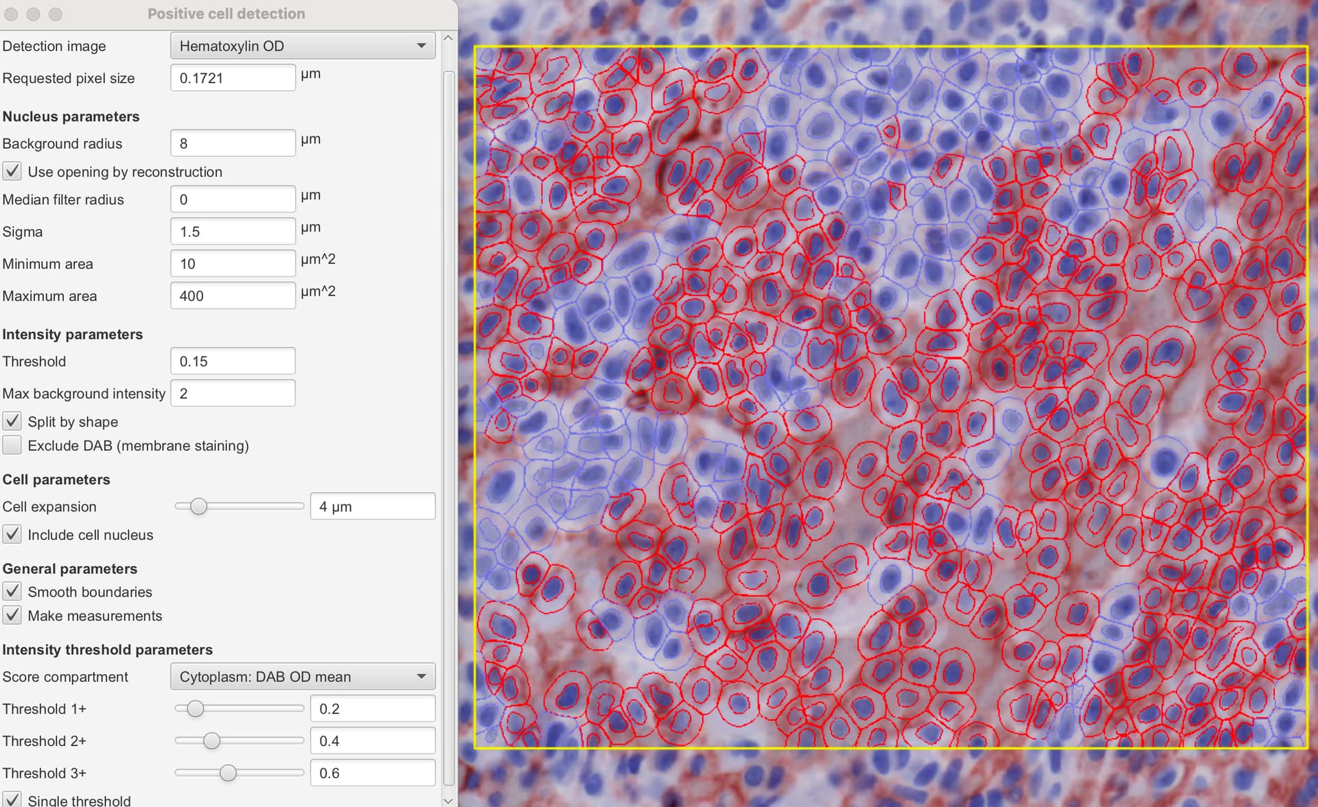Positive cell detection - false positives - Image Analysis - Image.sc Forum