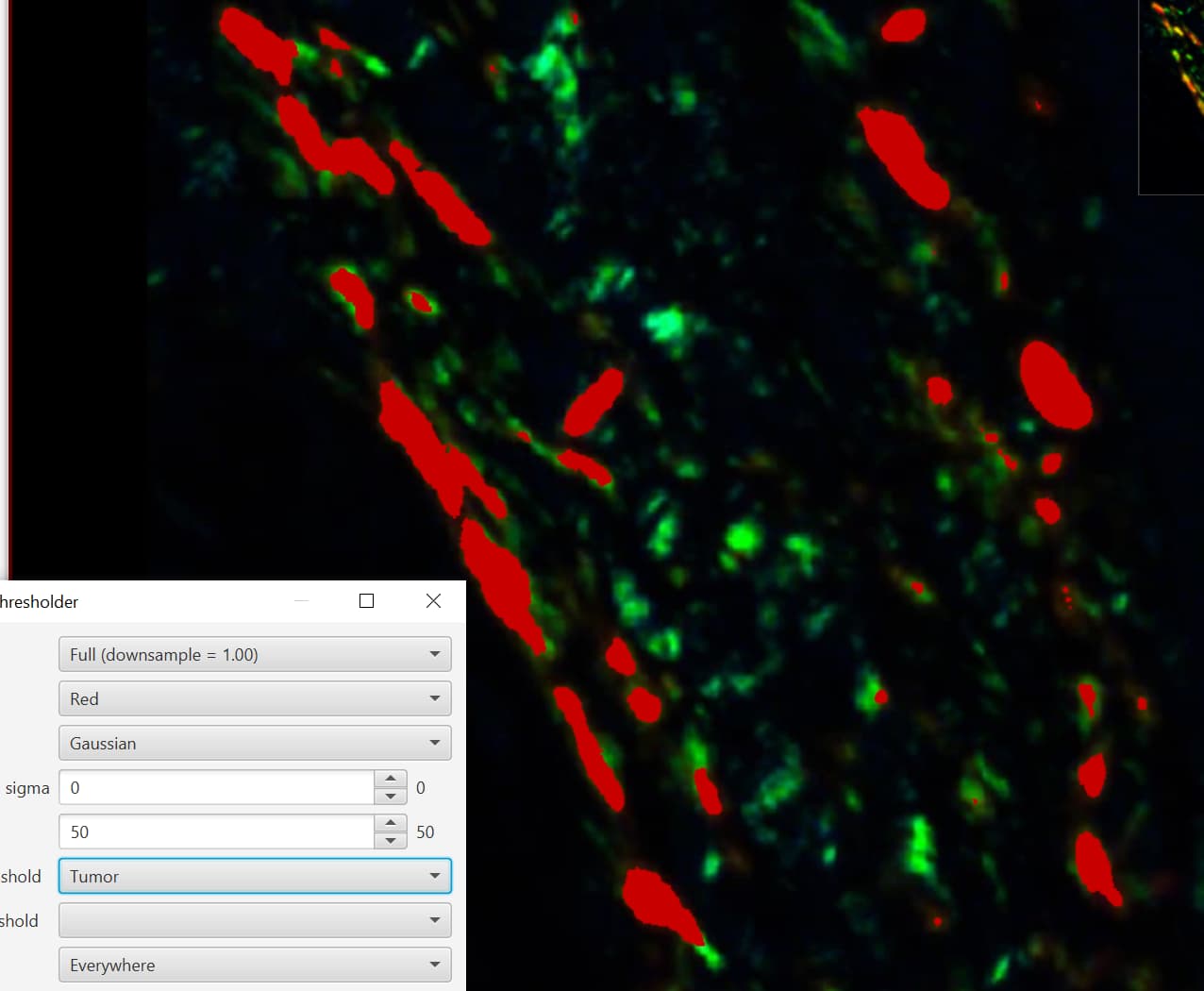 Analysing Picrosirius red stain (polarised light) using qupath - Image Analysis - Image.sc Forum