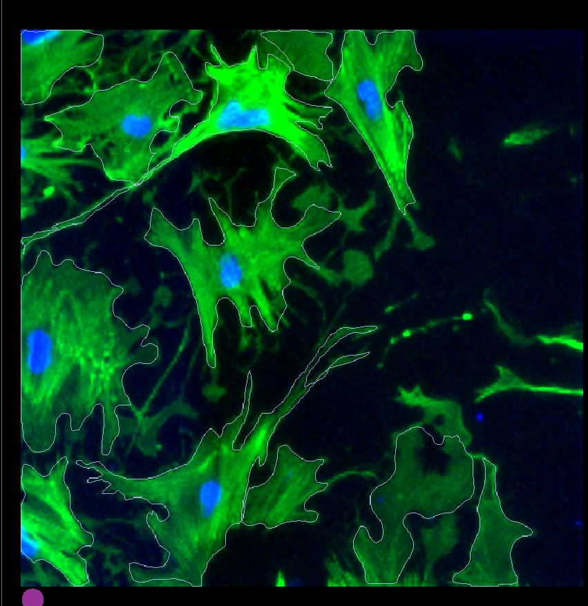 Challenging Segmentation With Cellpose Need Help Image Analysis Image Sc Forum
