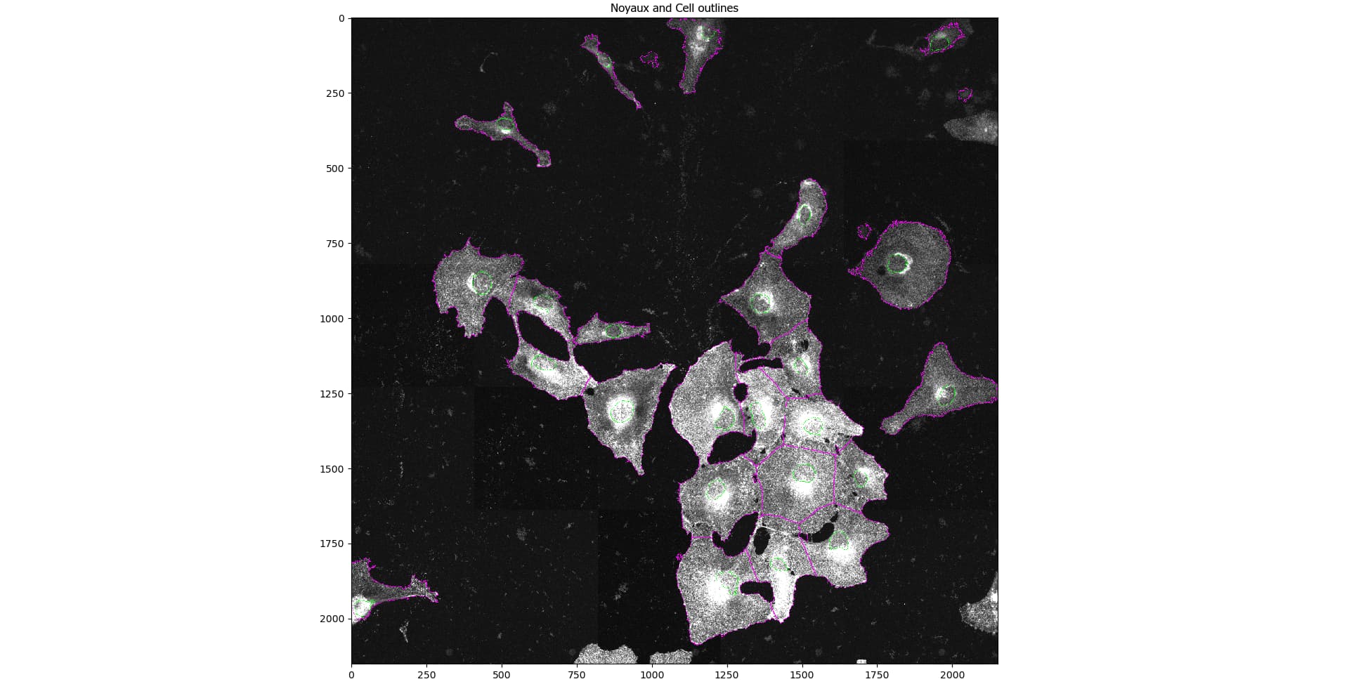 Issue to segment clumped object - Image Analysis - Image.sc Forum
