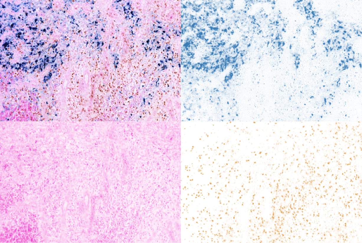 ᴗ•)/ QuPath scripting (#6): Customized 3 stain color deconvolution - Usage & Issues - Image.sc Forum