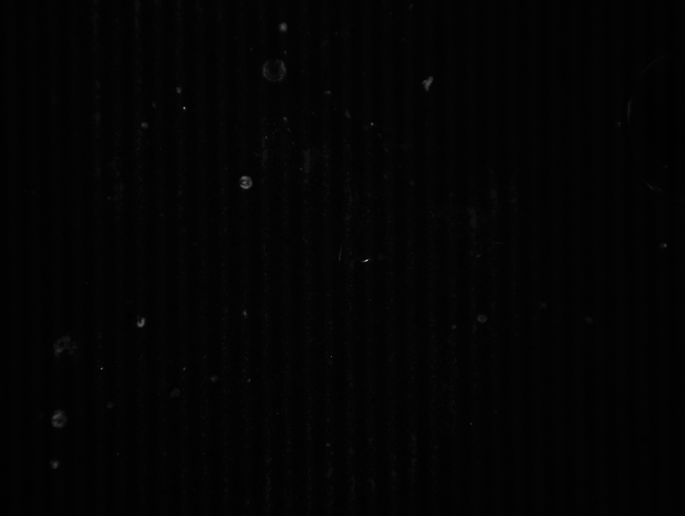 Microscopic Blur Detection Using Laplacian - Image Analysis - Image.sc ... Microscopic Blur Detection Using Laplacian - Image Analysis - Image.sc ...