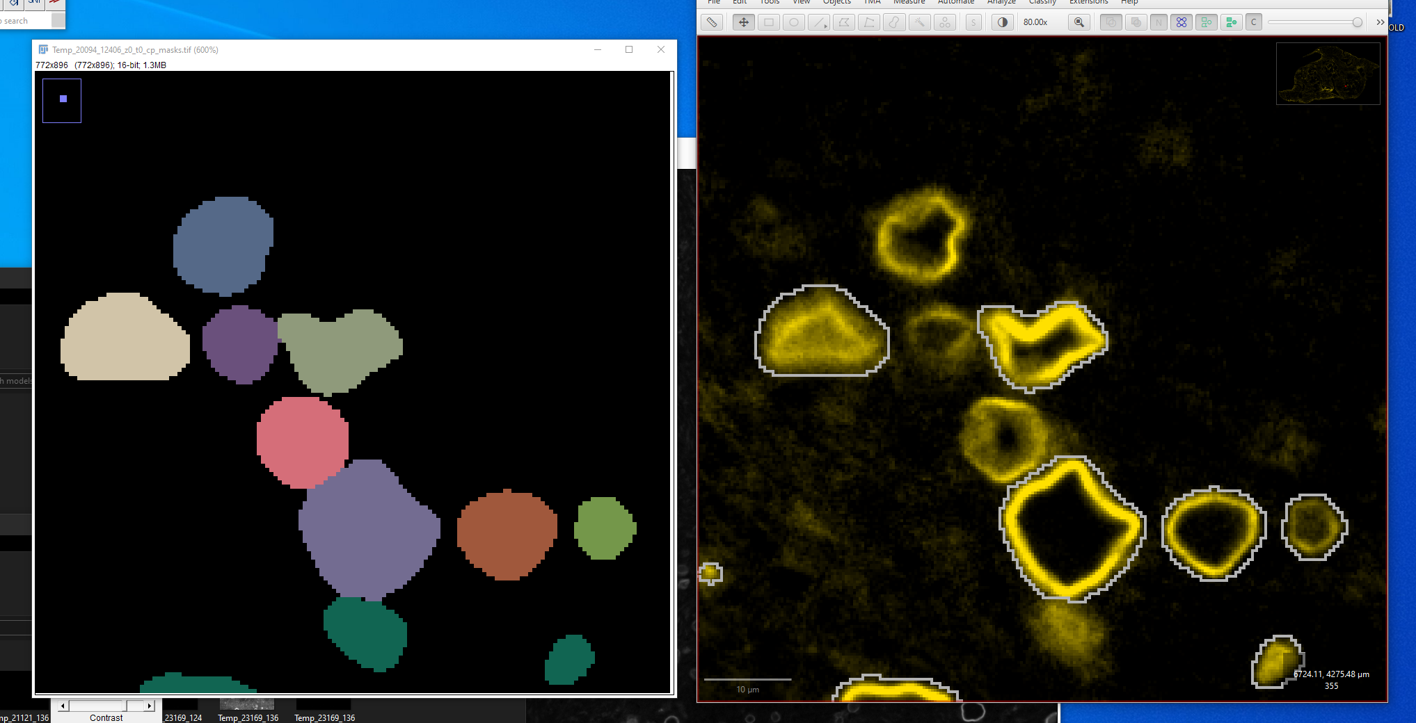 QuPath Cellpose extension refusing to create touching cells - Usage & Issues - Image.sc Forum