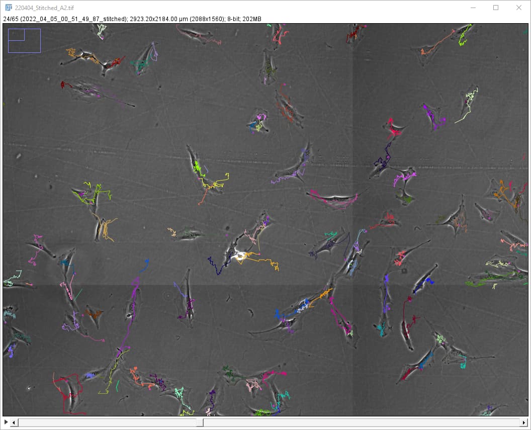 Trackmate: how to reopen XML file over original dataset - Usage & Issues - Image.sc Forum