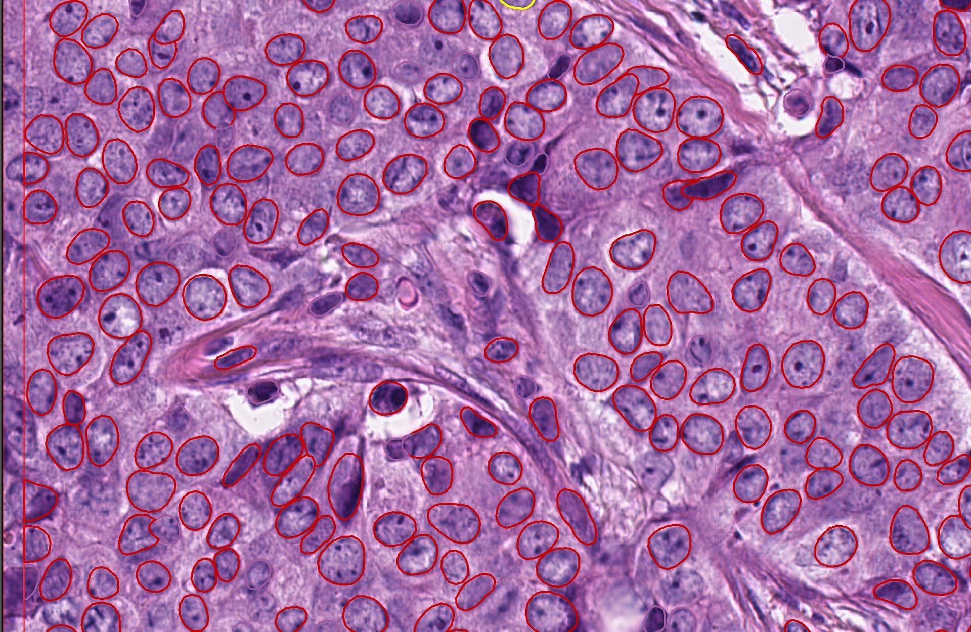 Internuclear distance - Image Analysis - Image.sc Forum