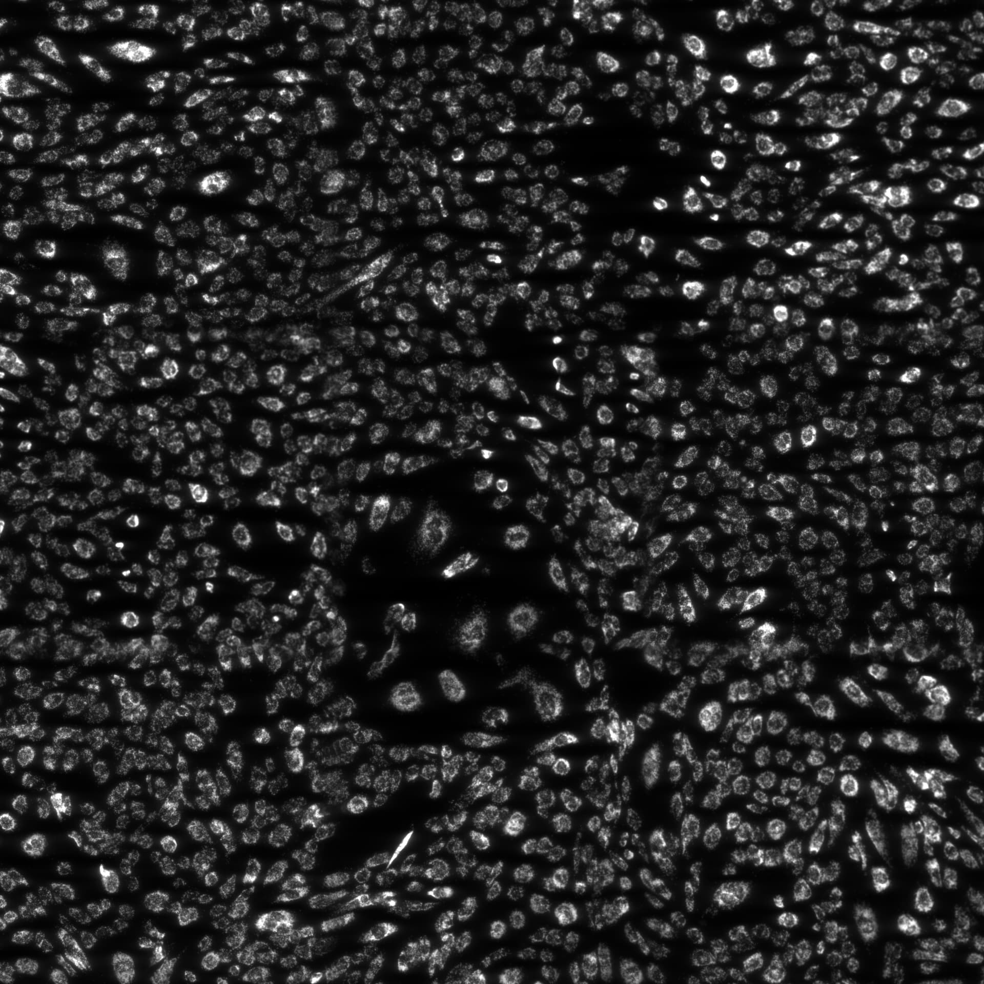 RNA scope imaging and quantification - Image Analysis - Image.sc Forum