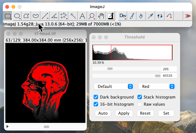 Theshold on stack histogram using GUI bug? - Usage & Issues - Image.sc Forum