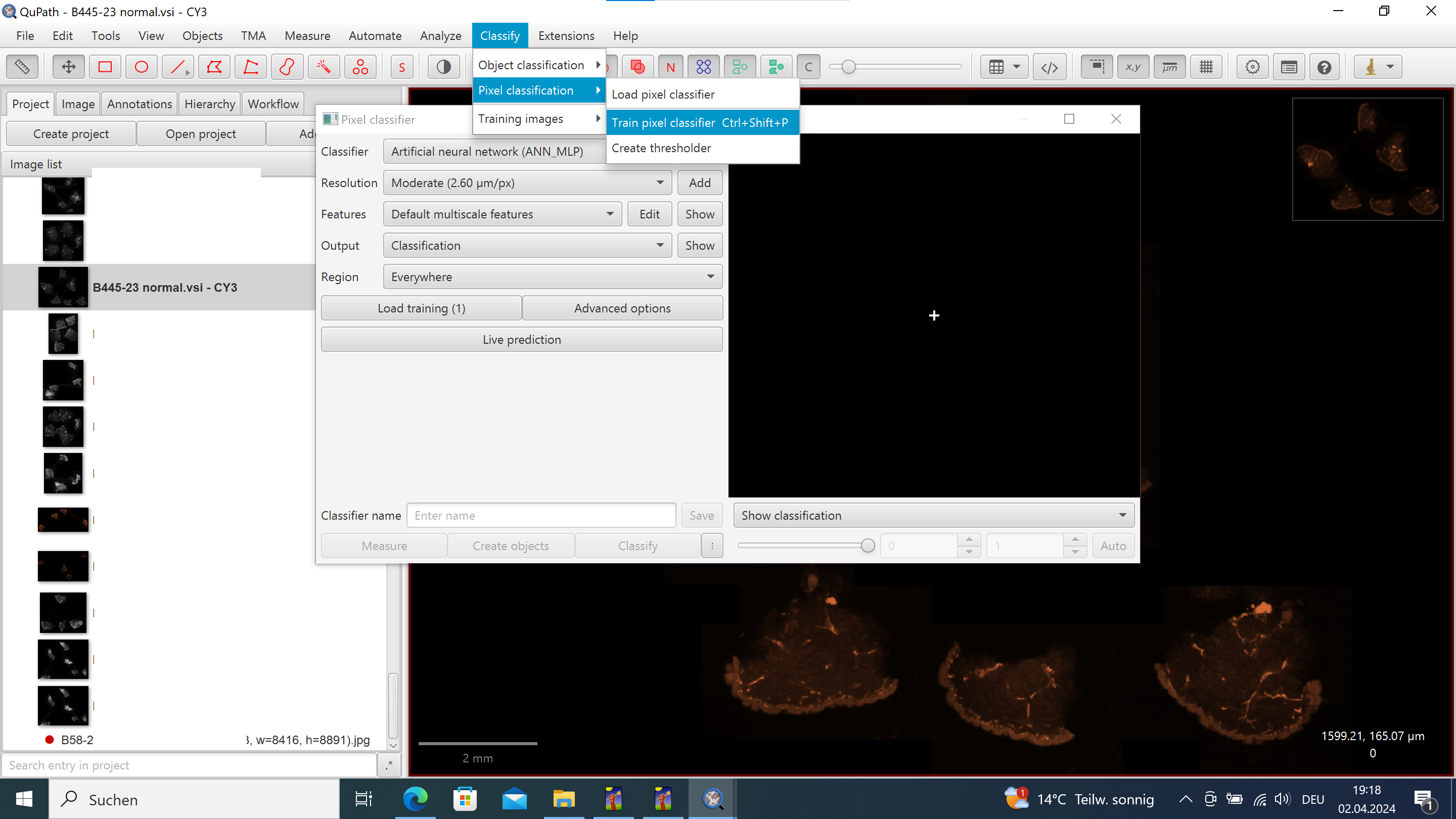 Train Pixel Classifier nervefiber density - Image Analysis - Image.sc Forum
