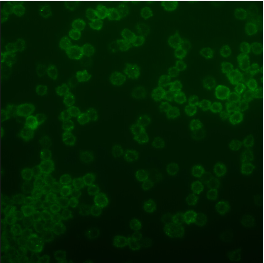 How to do threshold , image segmentation and measure signal intensity on ring like structure ...