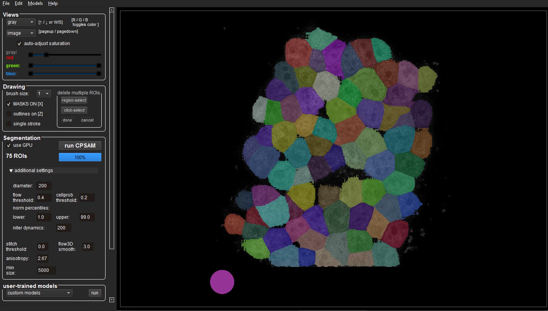Segmenting Densely Packed Nuclei in 3D - Image Analysis - Image.sc Forum