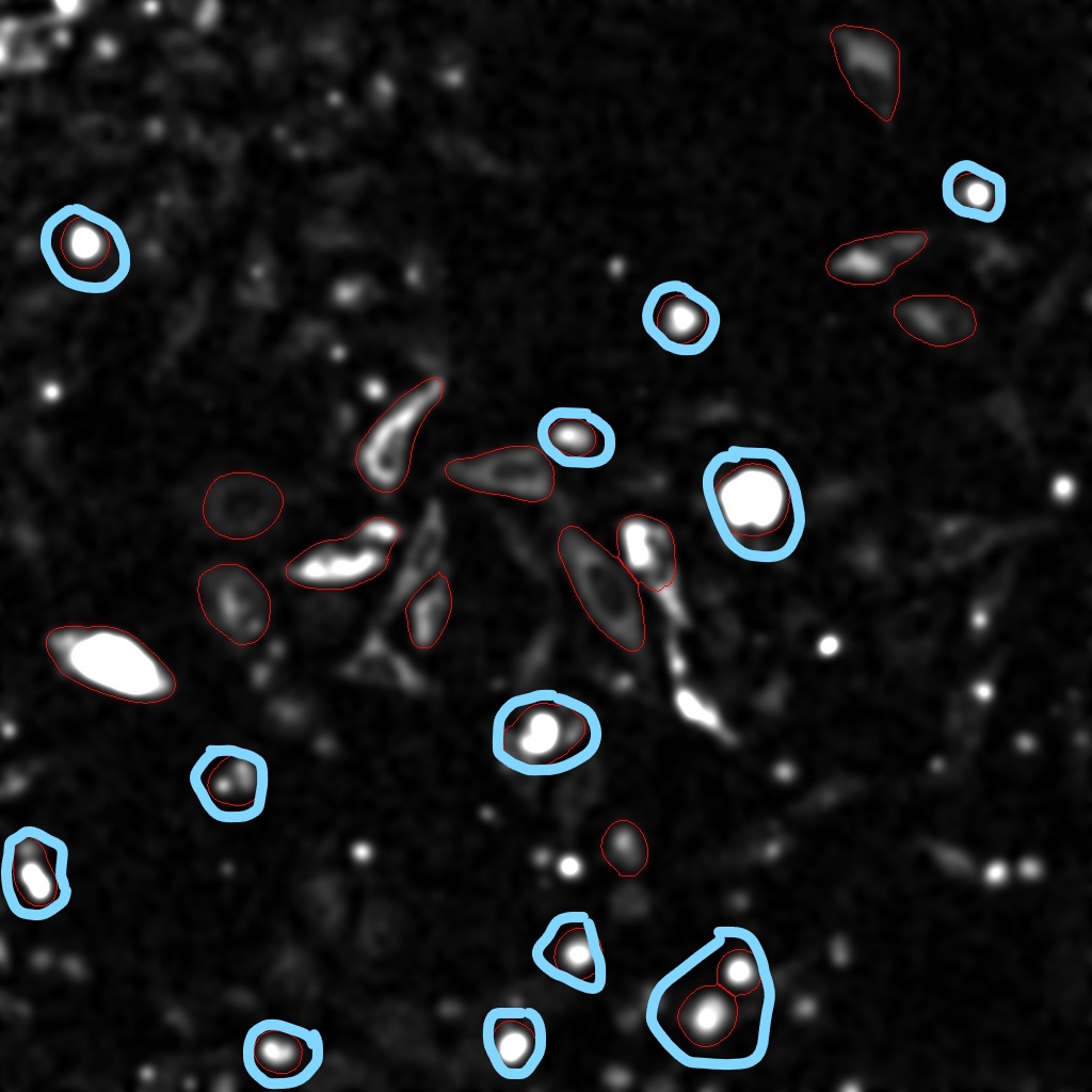 Cellpose exclude rounded (dead) cells from mask - Image Analysis ...